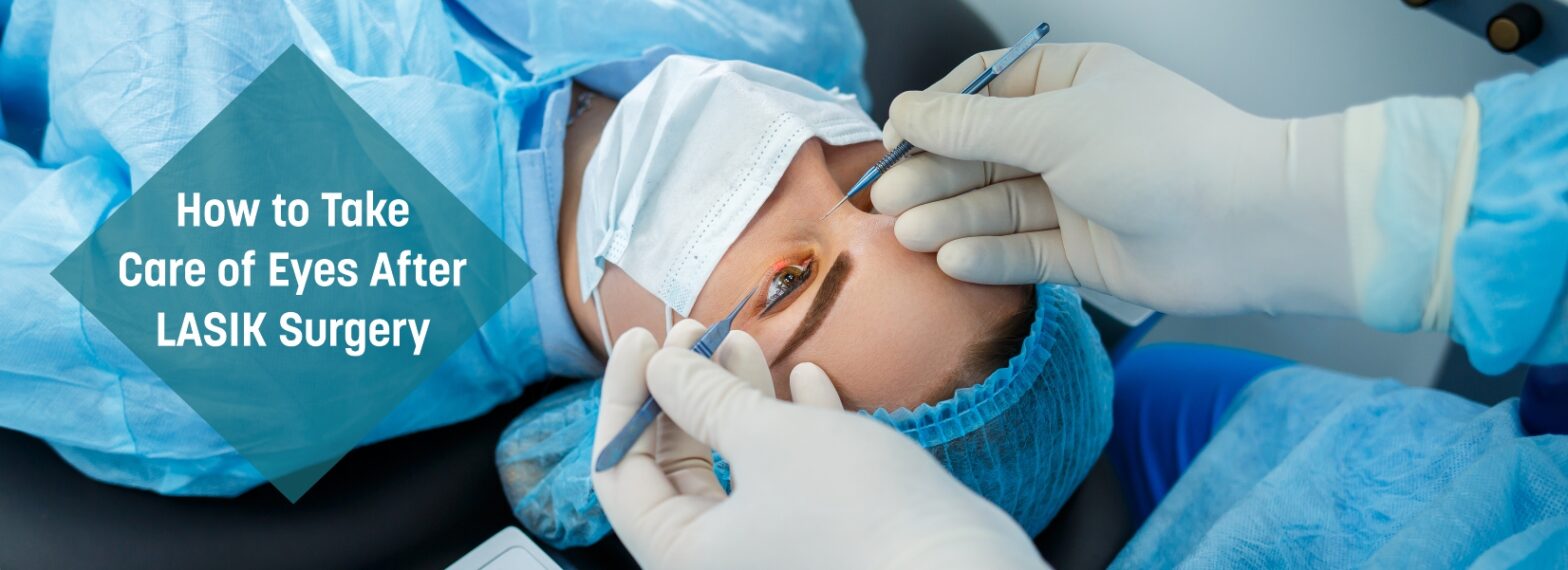 How to Take Care of Eyes After LASIK Surgery – My blog